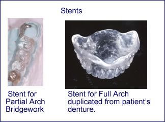 Dental Implants - Edward Feinberg, DMD - Scarsdale NY Edward M ...